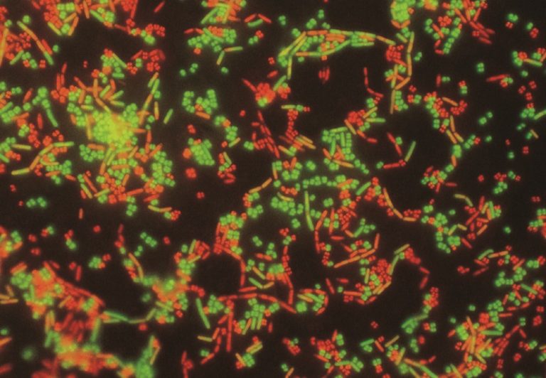 How Can You Tell if Bacteria are Alive or Dead? – Sustainable Nano Blog ...